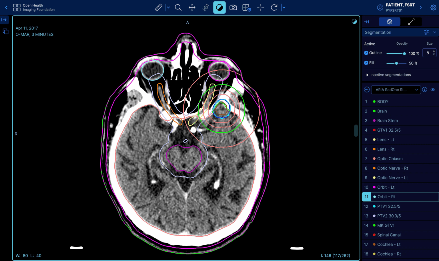 OHIF Viewer - browser-based medical imaging viewer - LinuxLinks